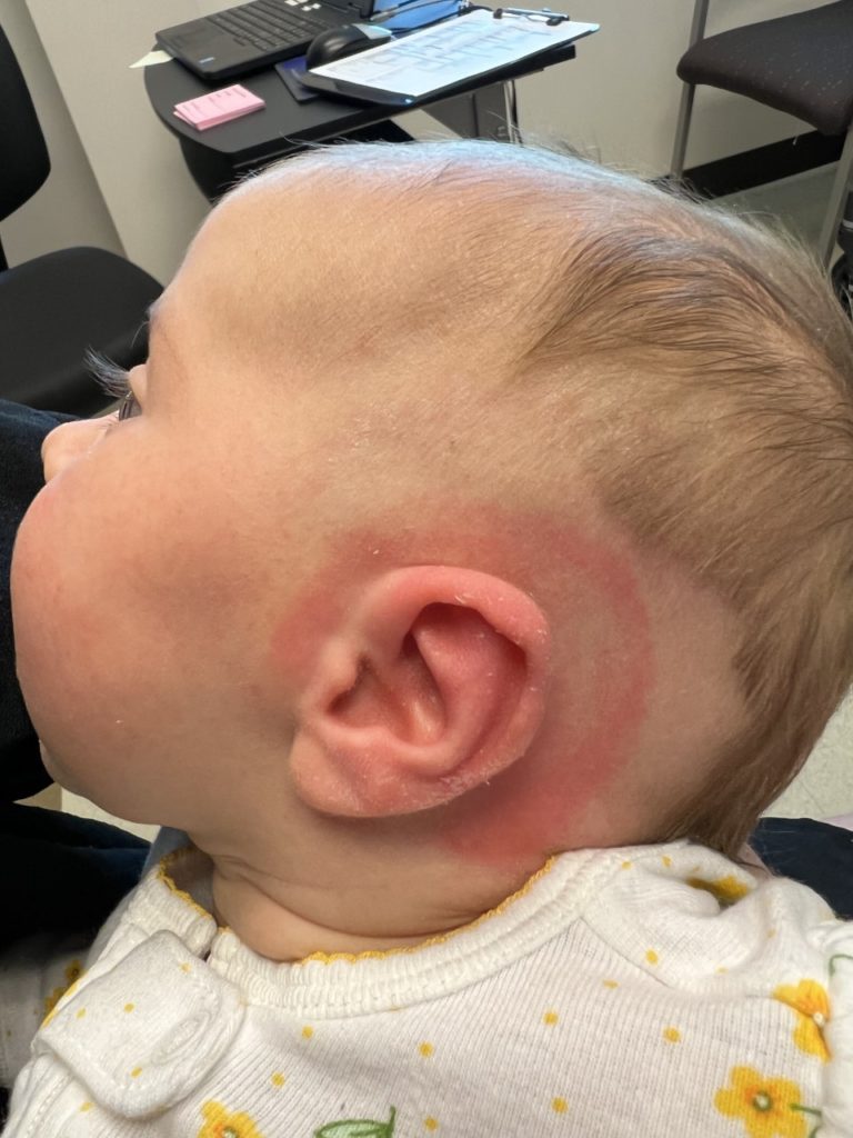 EarWell in Denver, Lone Tree & Castle Rock, CO AOO | ENT Specialists of ...